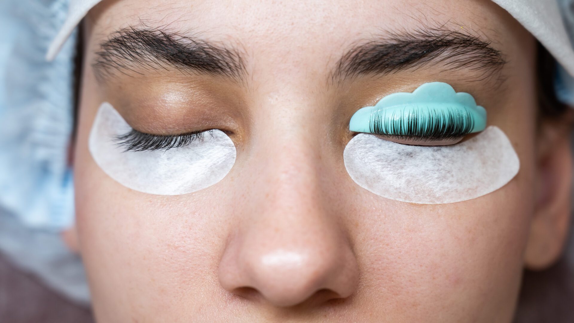 Spa Treatments | East Bay Dermatology & Plastic Surgery | NY