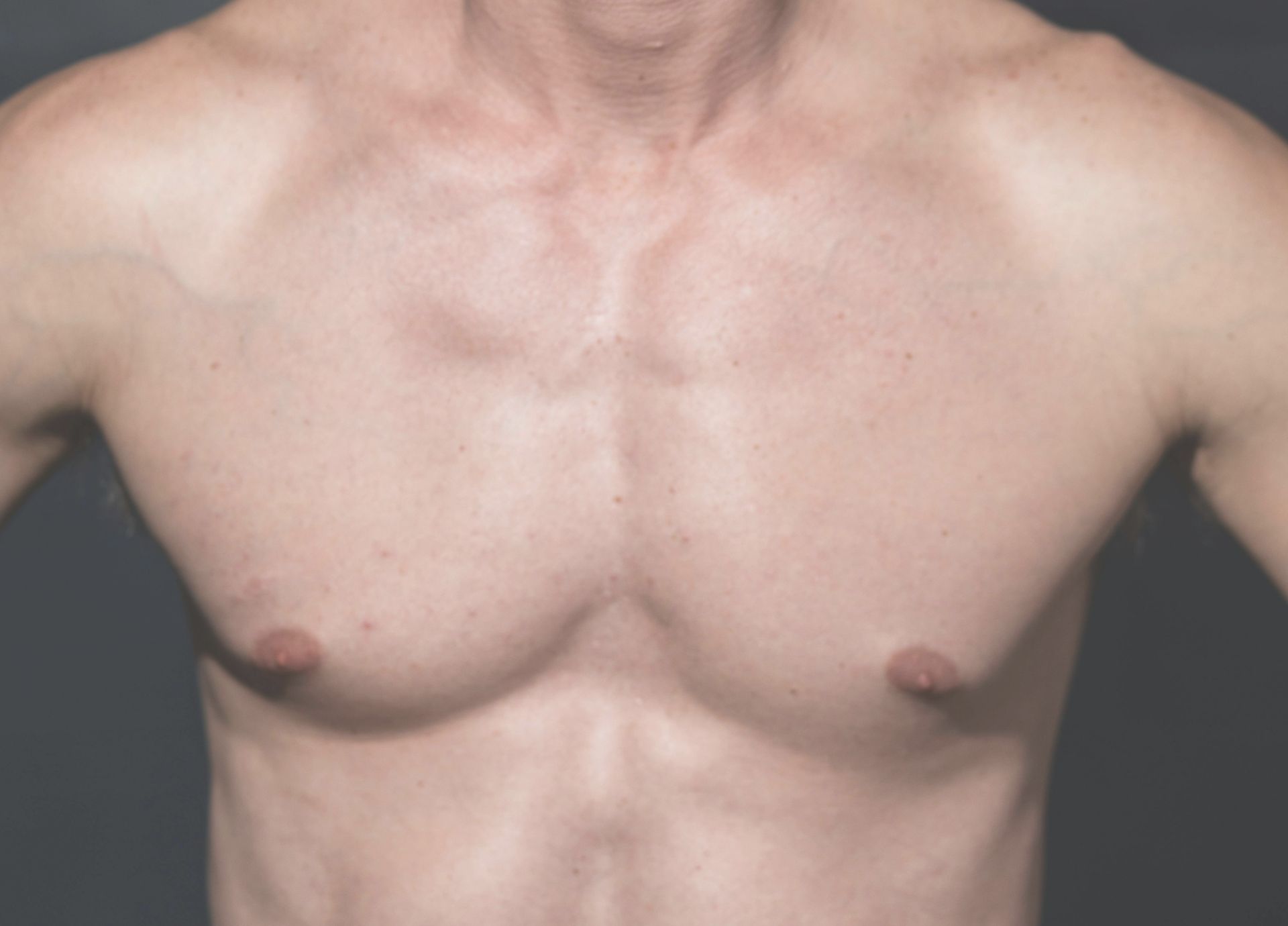 Surgical Treatments | East Bay Dermatology & Plastic Surgery | NY